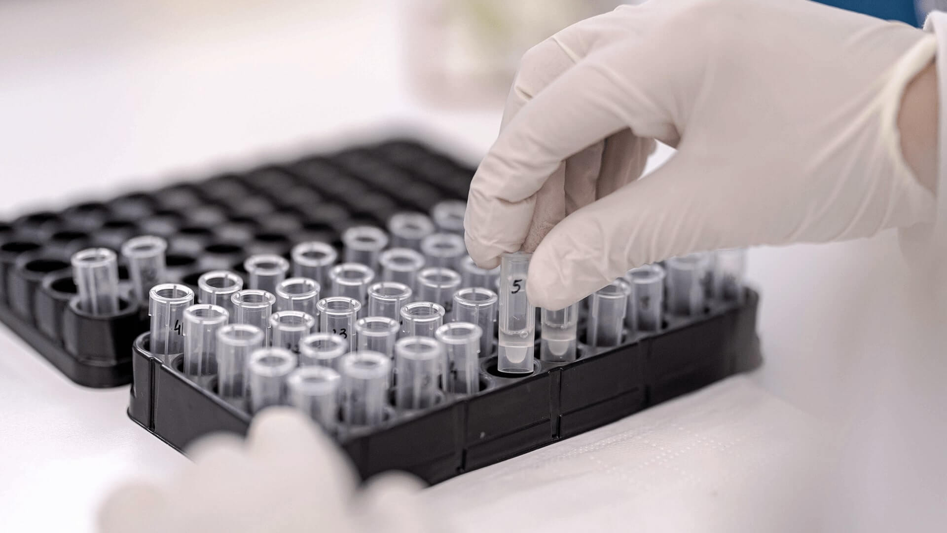 Medical Genetics Laboratory | JCS