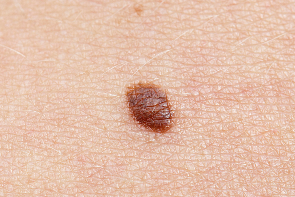 Private Dermatology Consultants for Skin Conditions | Pall Mall | Pall Mall